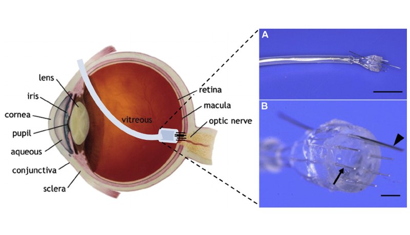 bionic-vision.org | Implants | AV-DONE