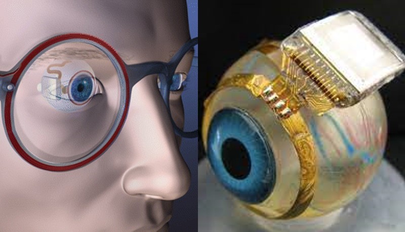 bionic-vision.org | Implants | Boston Retinal Implant