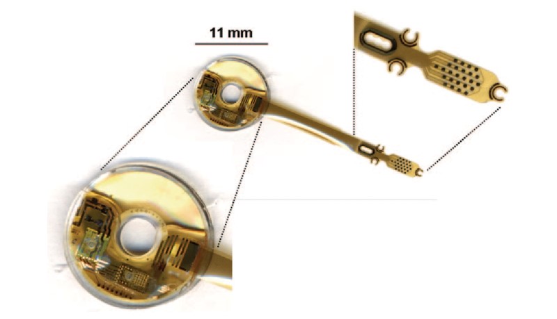 bionic-vision.org | Implants | EPIRET3