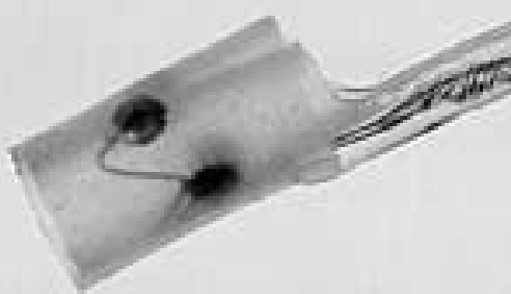 bionic-vision.org | Implants | MiViP Optic Nerve Visual Prosthesis