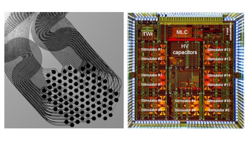bionic-vision.org | Implants | Phoenix 99