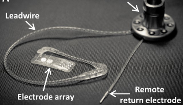 bionic-vision.org | Implants | Suprachoroidal Prosthesis (24-channel)