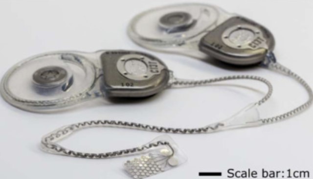 bionic-vision.org | Implants | Suprachoroidal Prosthesis (44-channel)