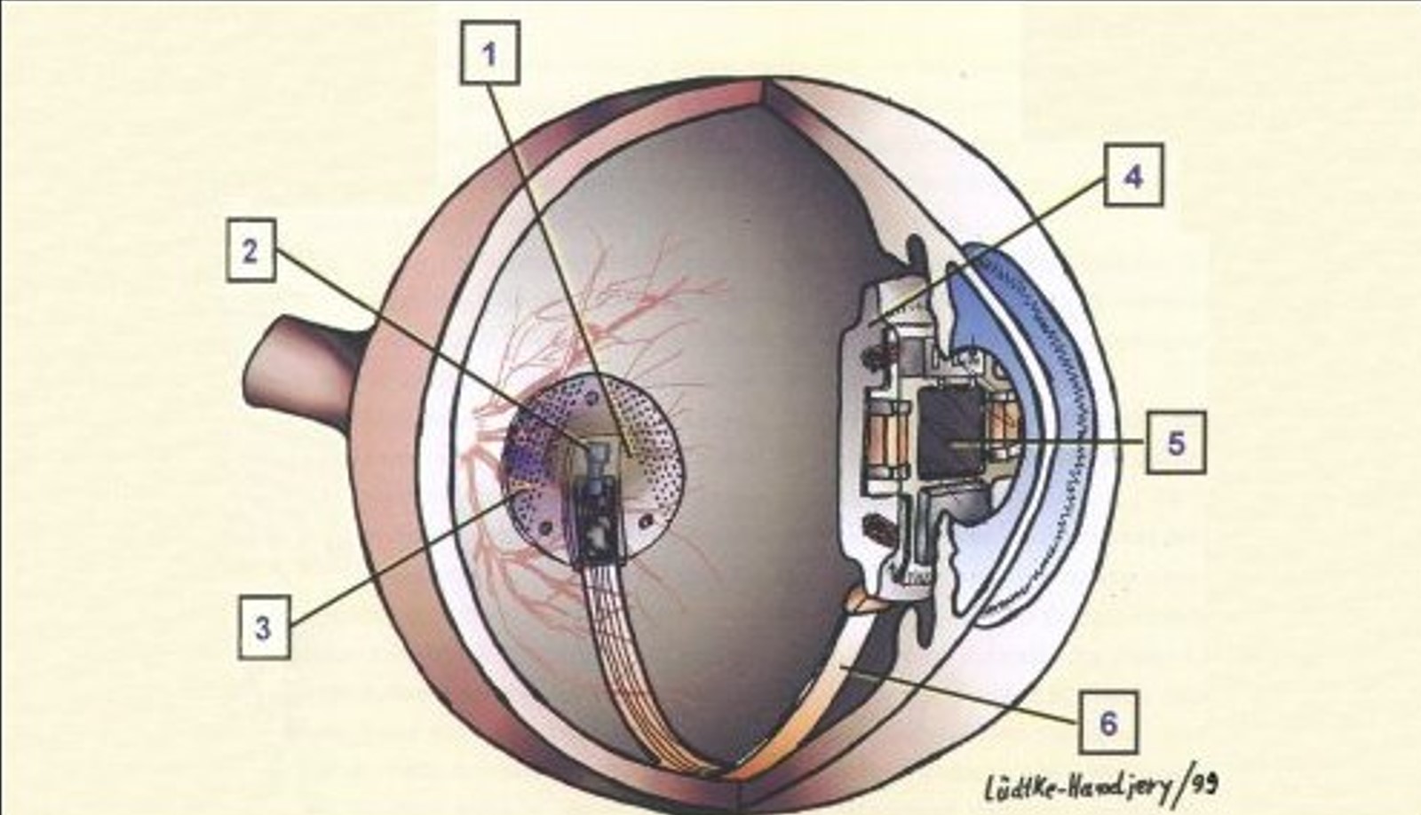 bionic-vision.org | Consortia | EPI-RET